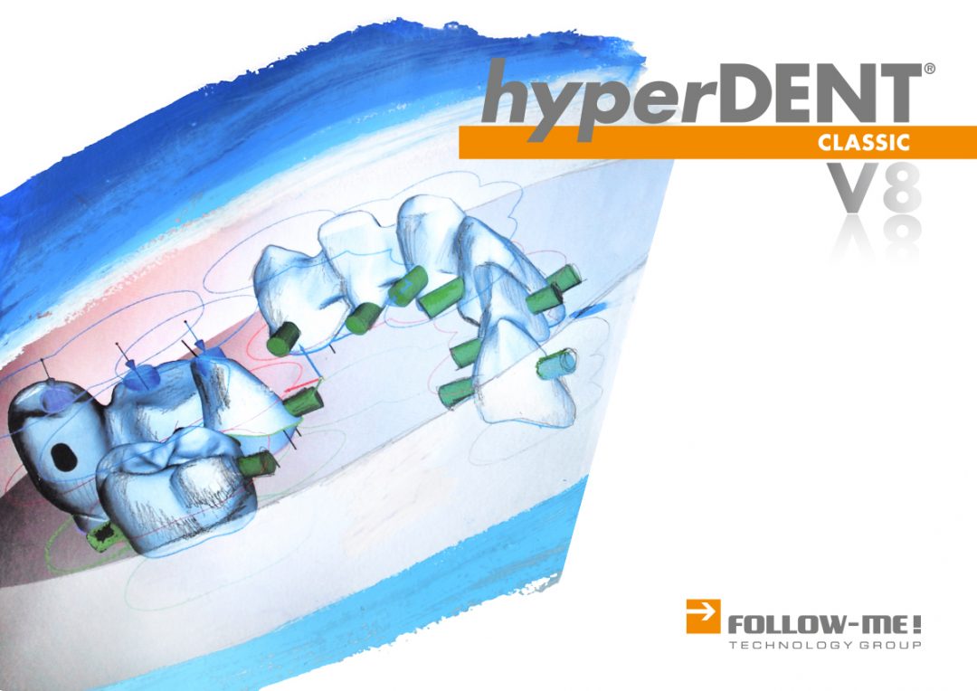 HyperDENT V8.2 5-Achs Compact (inkl. Toolpath packages & Postprozessor ...